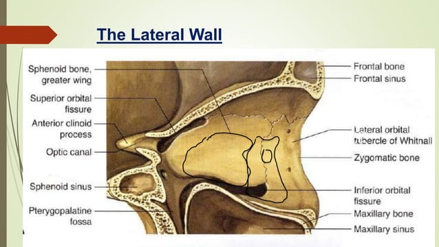 Anatomy of human orbit | PPTX