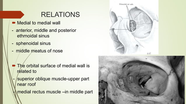 Anatomy of human orbit | PPTX