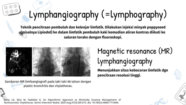 RAY - chylothorax.pptx
