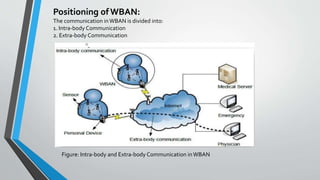 Wireless Body Area Network (WBAN) by Rayhan Khoka | PPTX