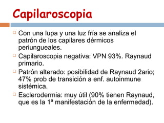 Fenómeno de Raynaud | PPT