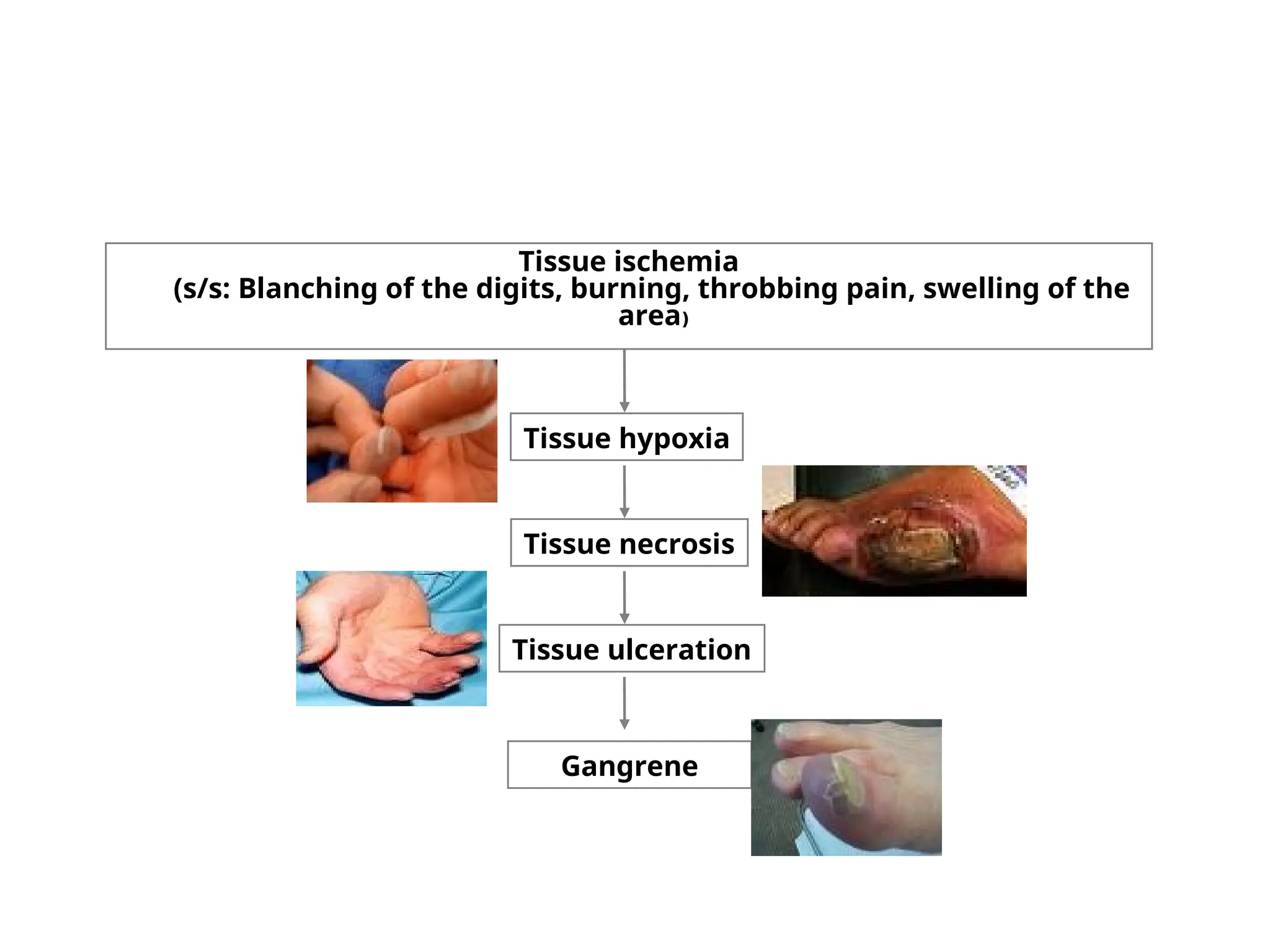 Raynaud's Disease presentation in detail | PPT