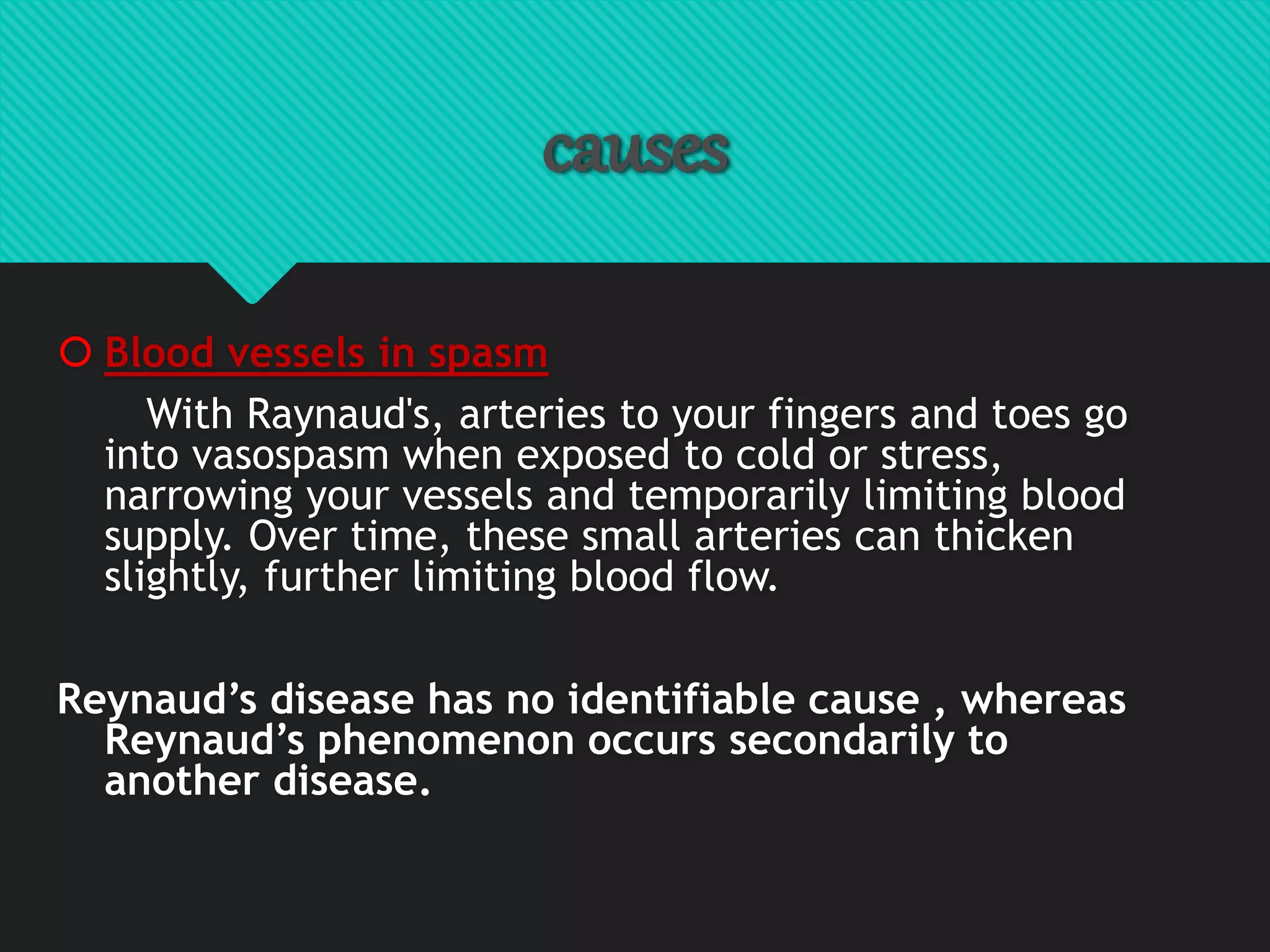 Nursing management Of patients with Raynaud's disease | PPTX