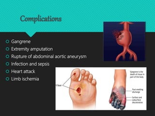 Nursing management Of patients with Raynaud's disease | PPTX