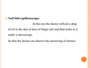 Raynauds disease | PPTX