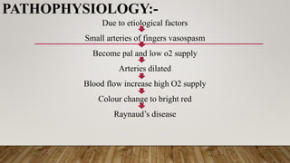 Raynaud's disease.pdf