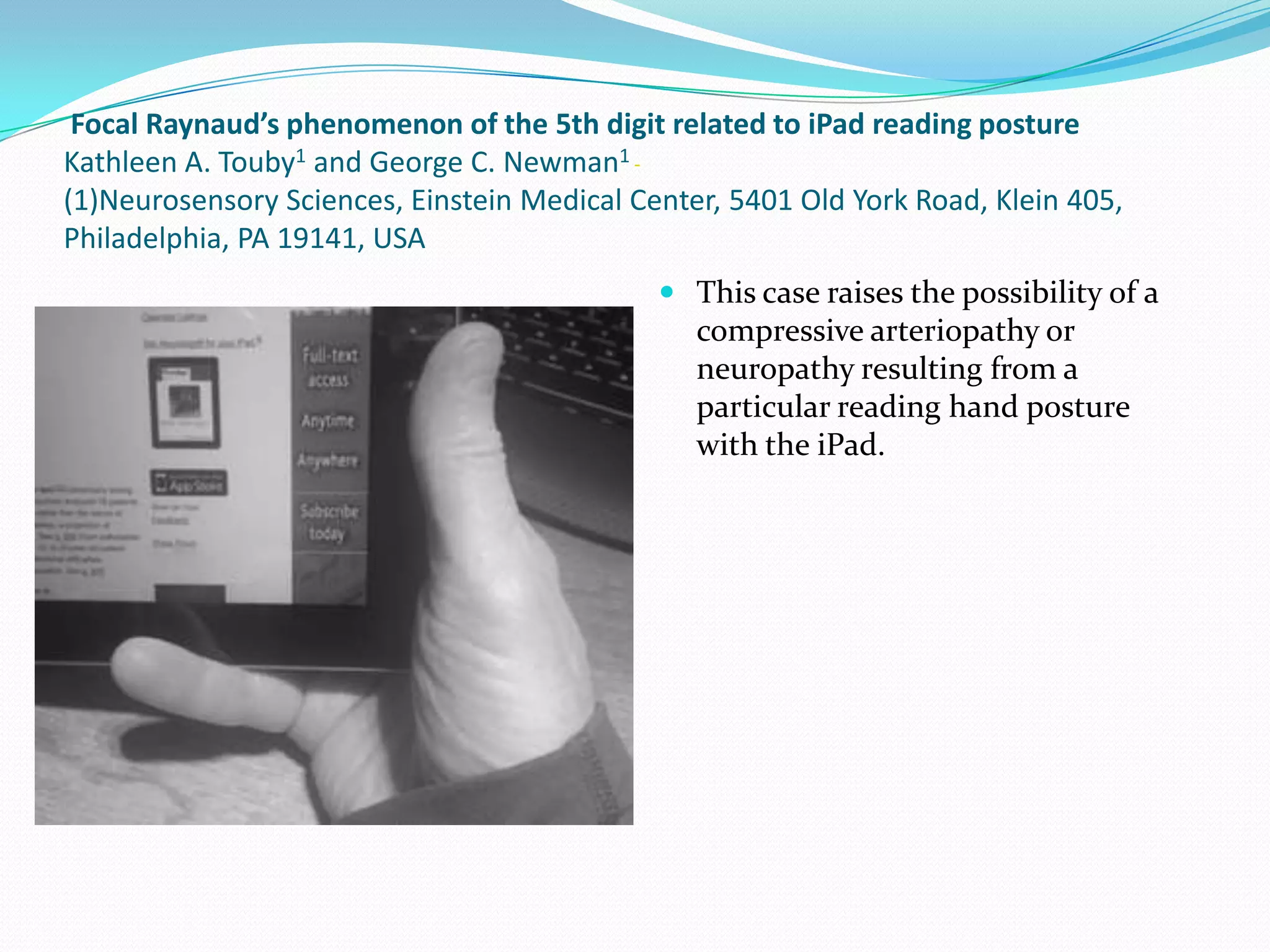Raynaud's phenomenon | PPTX