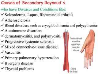 Raynauds phenomenon | PPTX