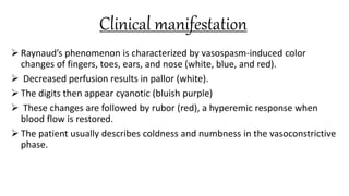 Raynauds phenomenon- nursing | PPTX