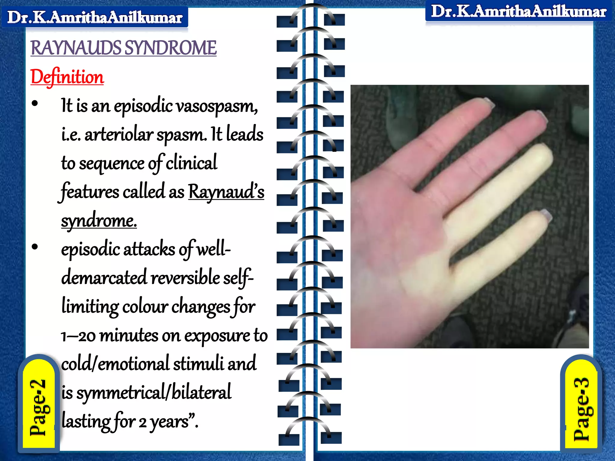 Raynauds syndrome by Dr.AmrithaAnilkumar | PPTX | Diseases and ...
