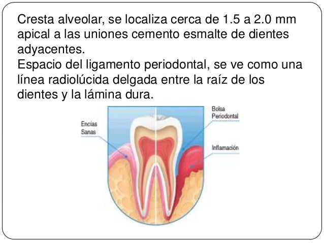 Rayos 1