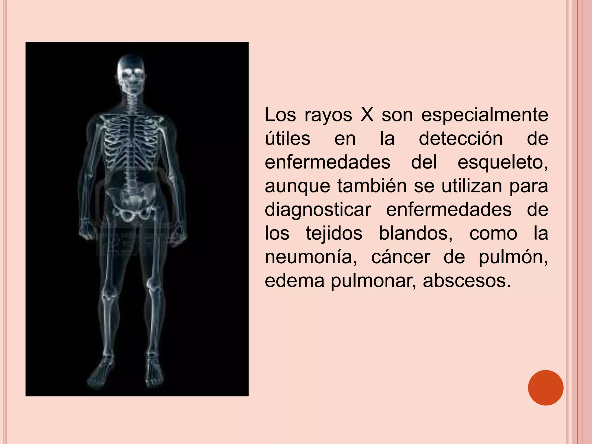 Rayos X | PPTX