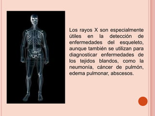 Rayos X | PPTX