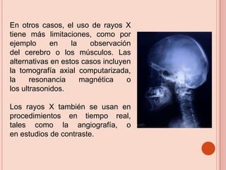Rayos X | PPTX