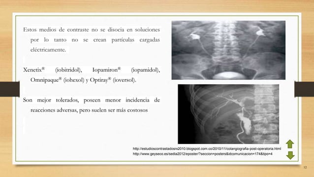Rayos X con Medios De Contraste | PPTX