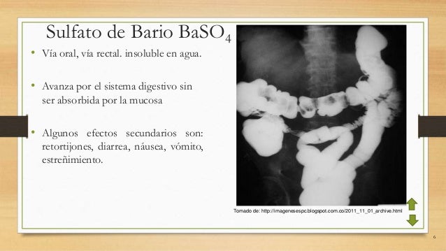 Rayos X con Medios De Contraste