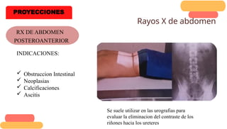 RAYOS X DE ABDOMEN.pptx IMPORTANCIA DE LA RAYOS X | PPTX