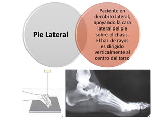 Rayos x de pie.pdf proyecciones para pie | PDF