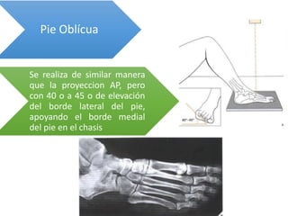Rayos x de pie.pdf proyecciones para pie | PDF