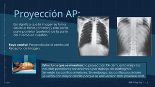 interpretacion de una Rayos X de Torax.pptx