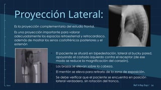 interpretacion de una Rayos X de Torax.pptx
