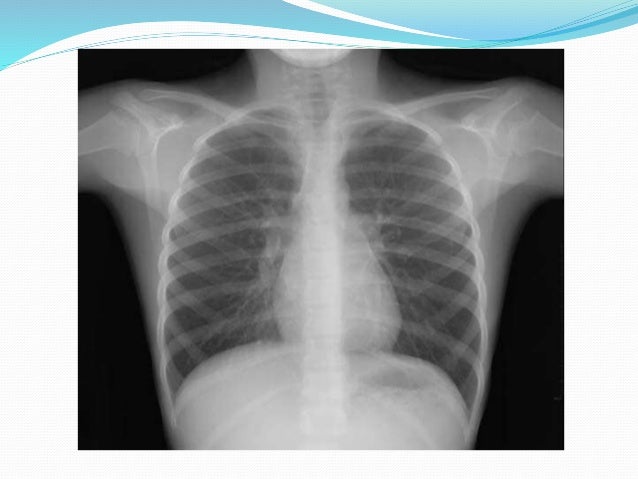 Rayos x de torax