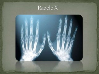 Razele x | PPTX