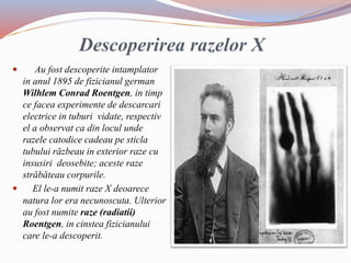 Razele X | PPTX