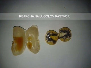 Razlike u građi jednosupnica i dvosupnica | PPTX