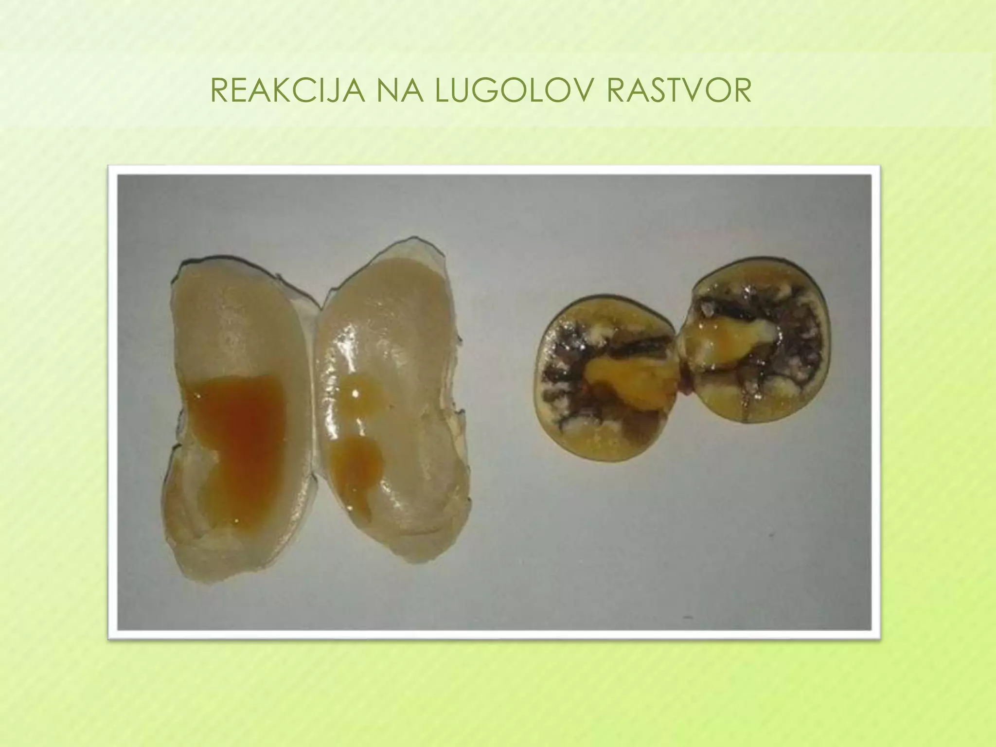 Sjemenka jednosupnica i dvosupnica | PPTX