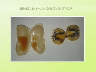 Sjemenka jednosupnica i dvosupnica | PPTX