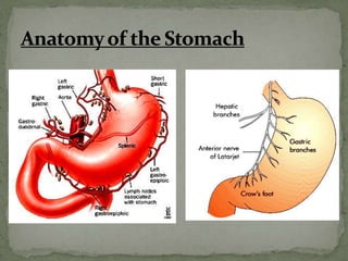Ca Stomach | PPTX