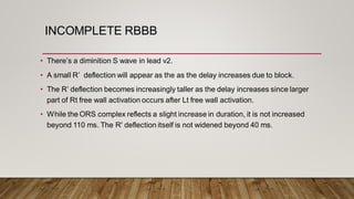 right bundle branch block ,rbbb,right heart failure | PDF