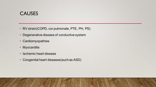 right bundle branch block ,rbbb,right heart failure | PDF