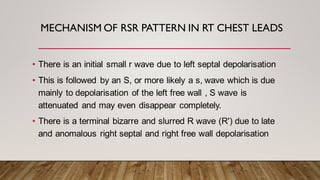 right bundle branch block ,rbbb,right heart failure | PDF