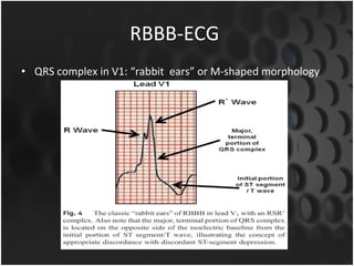 RBBB with STEMI | PPT