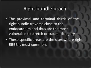 RBBB with STEMI | PPT