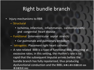 RBBB with STEMI | PPT
