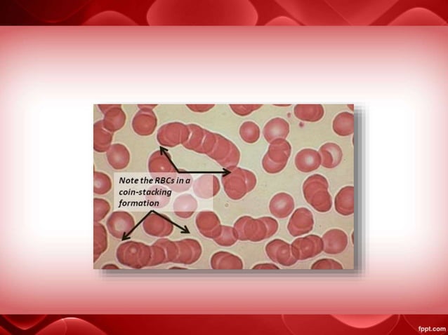 RBC | PPTX | Blood Disorders | Diseases and Conditions