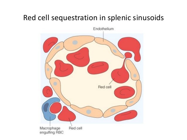 Rbc disorders-3