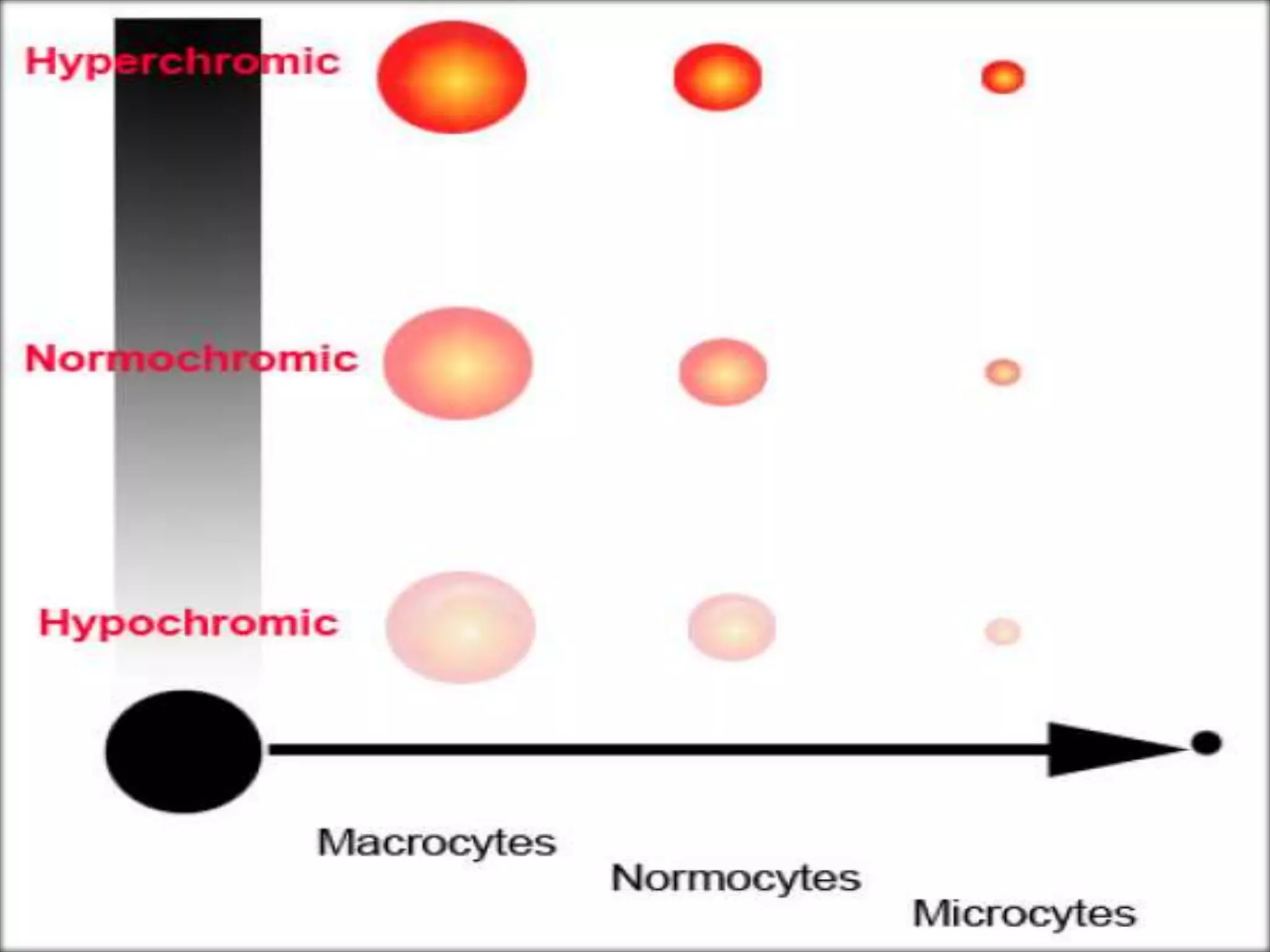 RBC Indices and Their Role in Differential Diagnosis of different types of Anemias: A Review | PPT