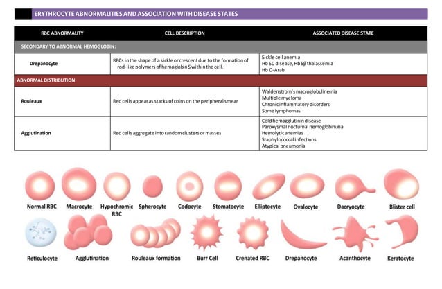 RBC Abnormalities | DOCX | Blood Disorders | Diseases and Conditions