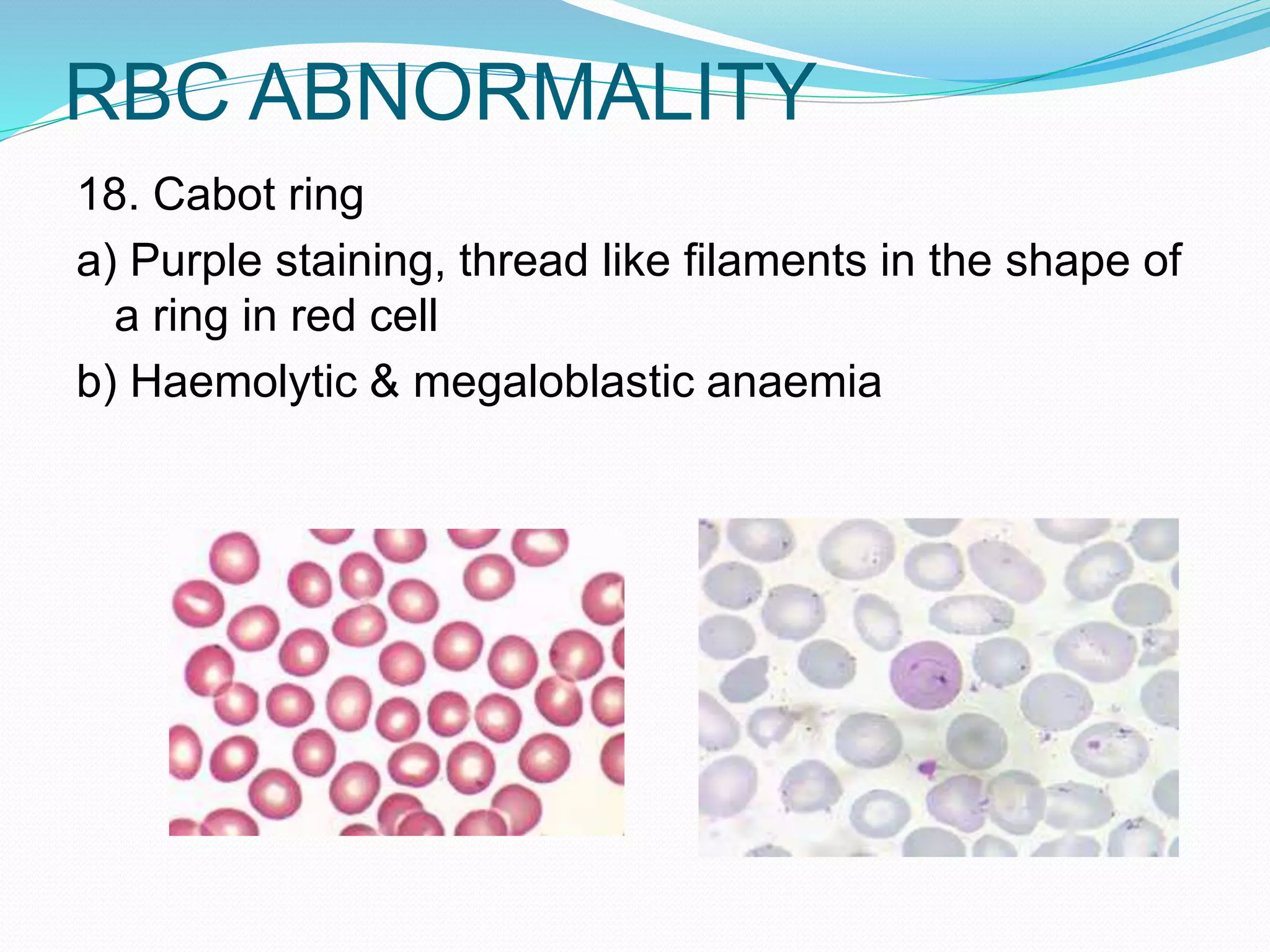 Rbc abnormality | PPTX