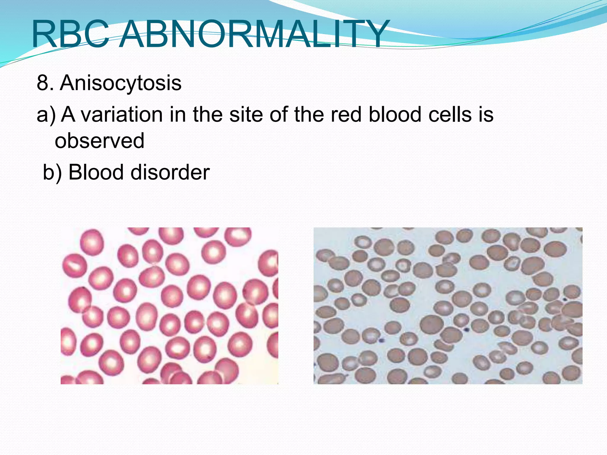 Rbc abnormality | PPTX