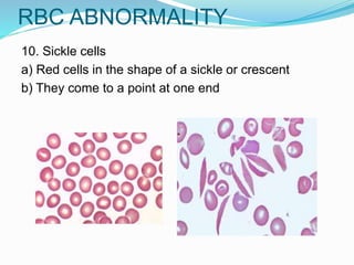 Rbc abnormality | PPTX