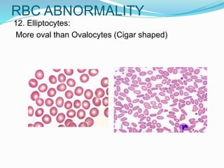 Rbc abnormality | PPTX