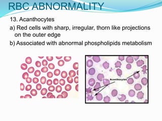 Rbc abnormality | PPTX