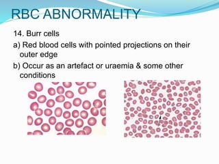 Rbc abnormality | PPTX