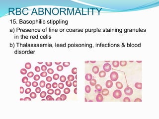Rbc abnormality | PPTX
