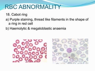 Rbc abnormality | PPTX